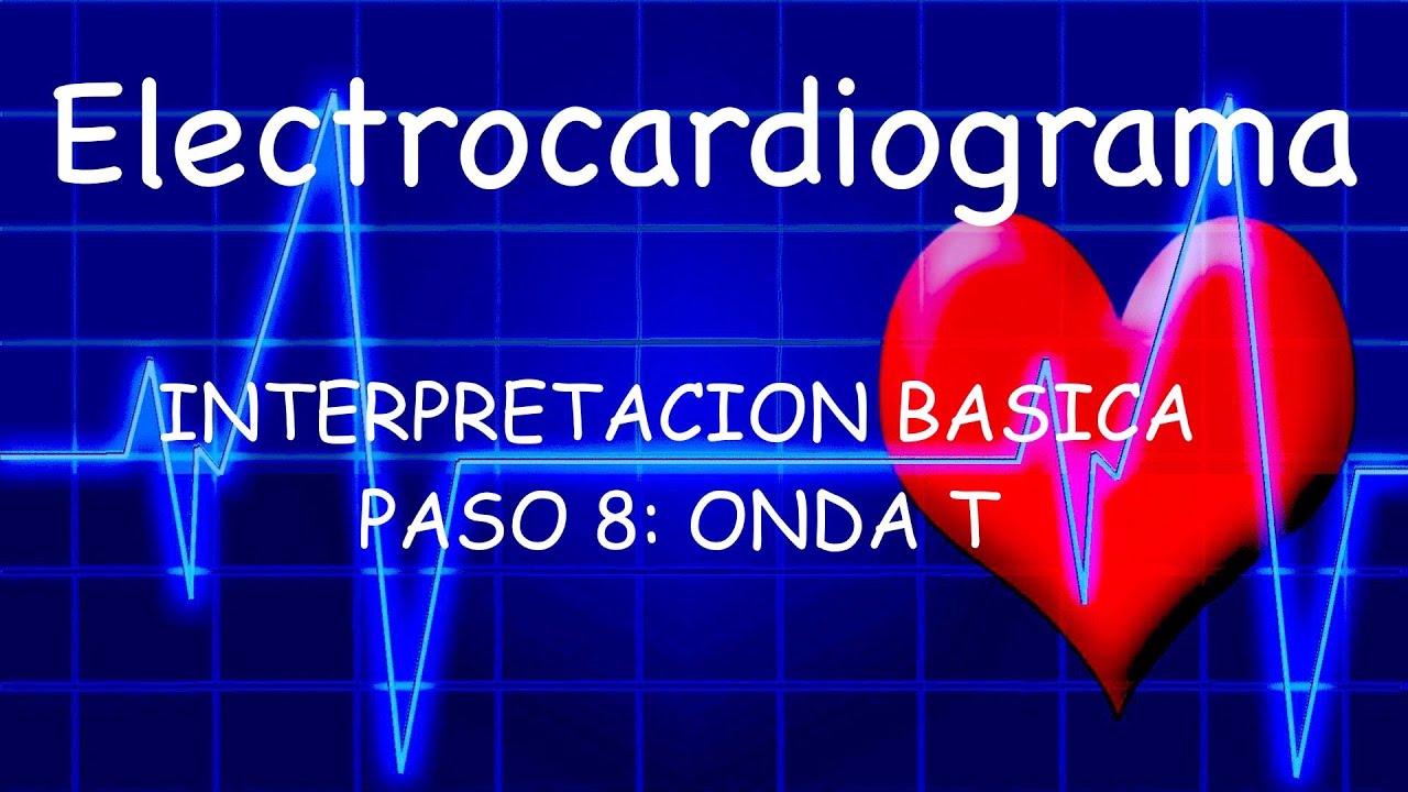 Electrocardiograma Básico: Onda T - YouTube