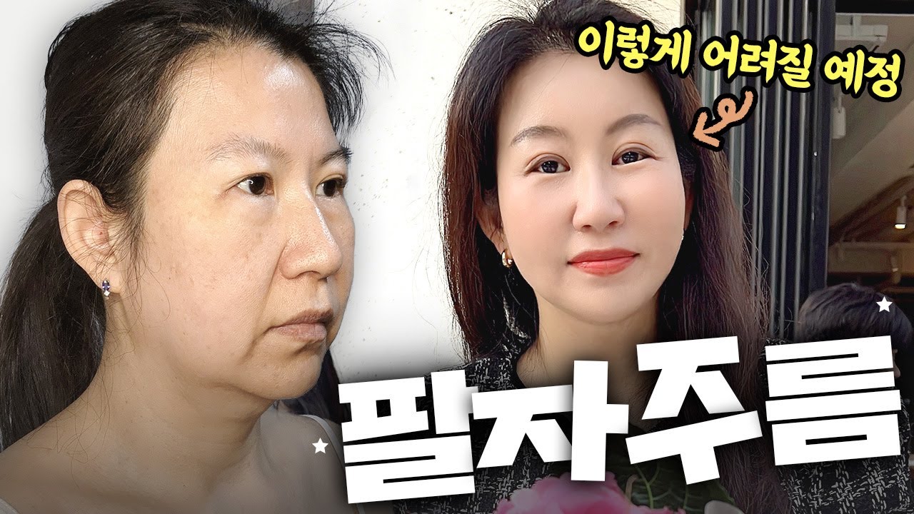 팔자주름 없앤 이 방법 L 이마거상 팔자 주름 리프팅 L 리프팅 브이로그 절개v리프팅 엘라스티꿈 아큐 L 인싸언니