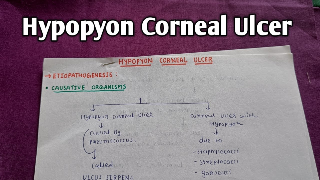 HYPOPYON CORNEAL ULCER | OPHTHALMOLOGY | A K KHURANA - YouTube