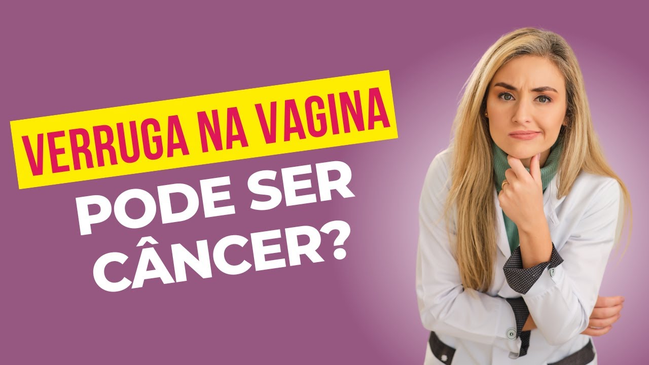 Verruga na vagina pode ser câncer? - YouTube