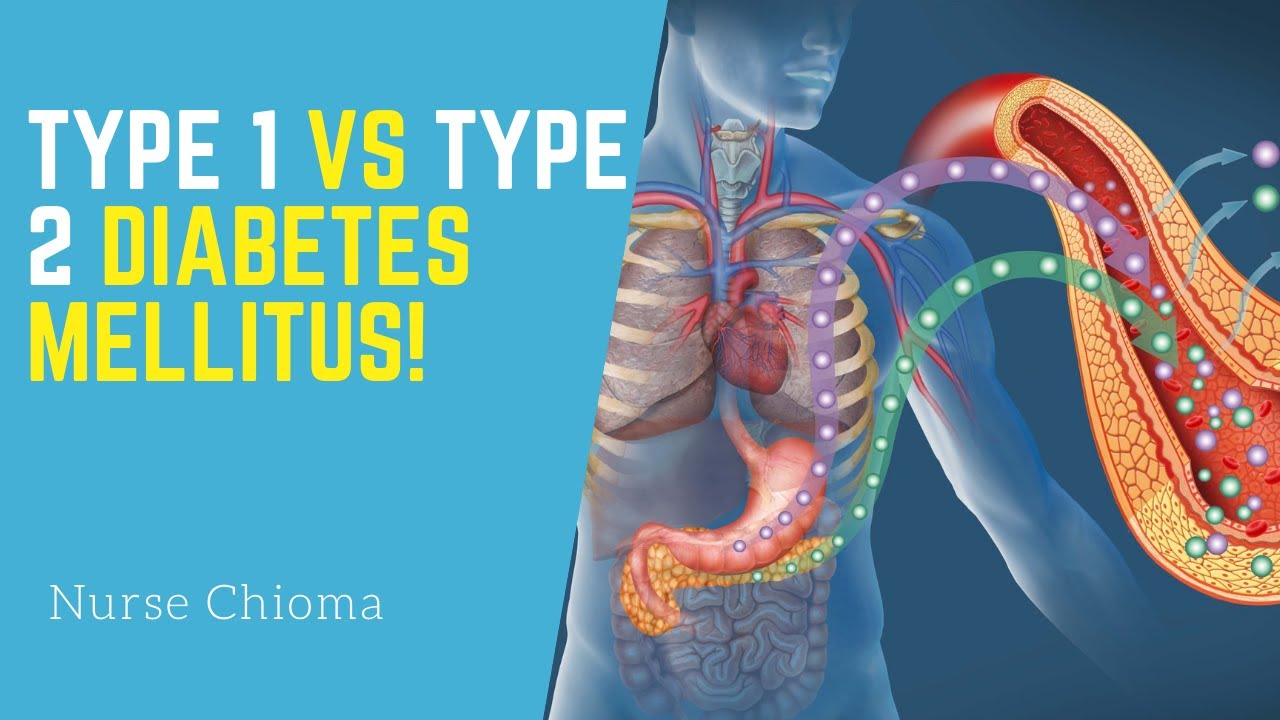 Type 1 Vs Type 2 Diabetes YouTube type-1-vs-type-2-diabetes-youtube