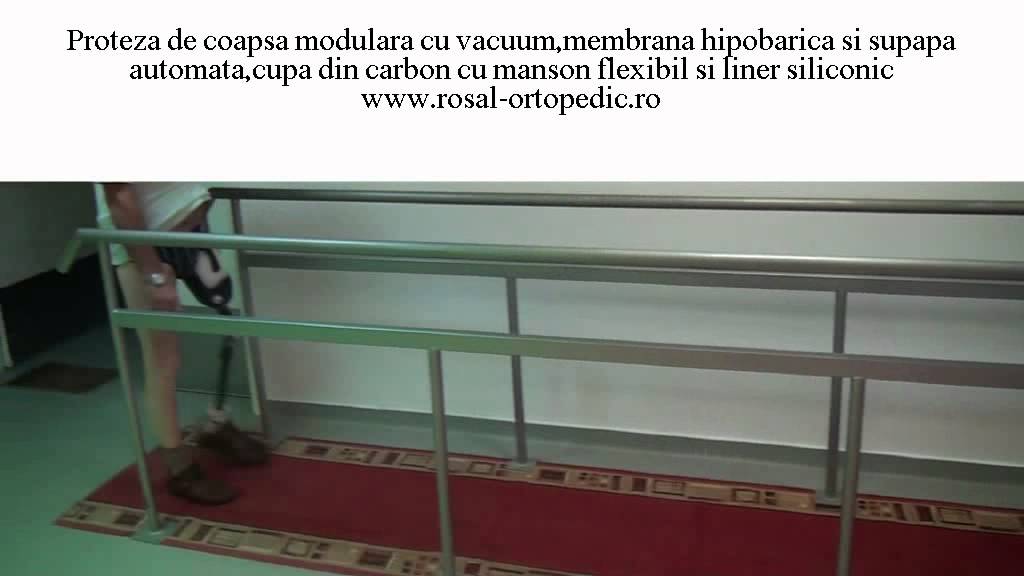 Proteza de coapsa modulara cu vacuum, model 4 - Rosal Ortopedic - YouTube