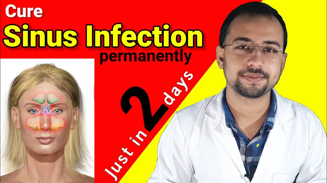 Cure sinus infection just in 2 days naturally | Sinusitis treatment ...