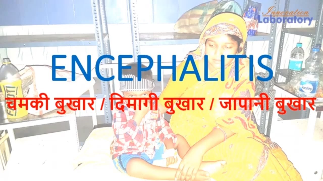 चमकी बुखार कारण लक्षण और इलाज के बारे में पूरी जानकारी |full details of ...