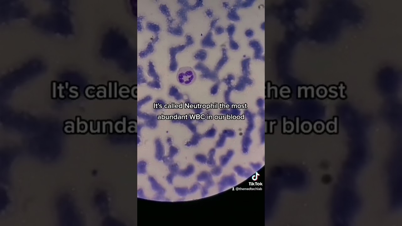 Neutrophil under the microscope #microscope #bloodcells #wbc # ...