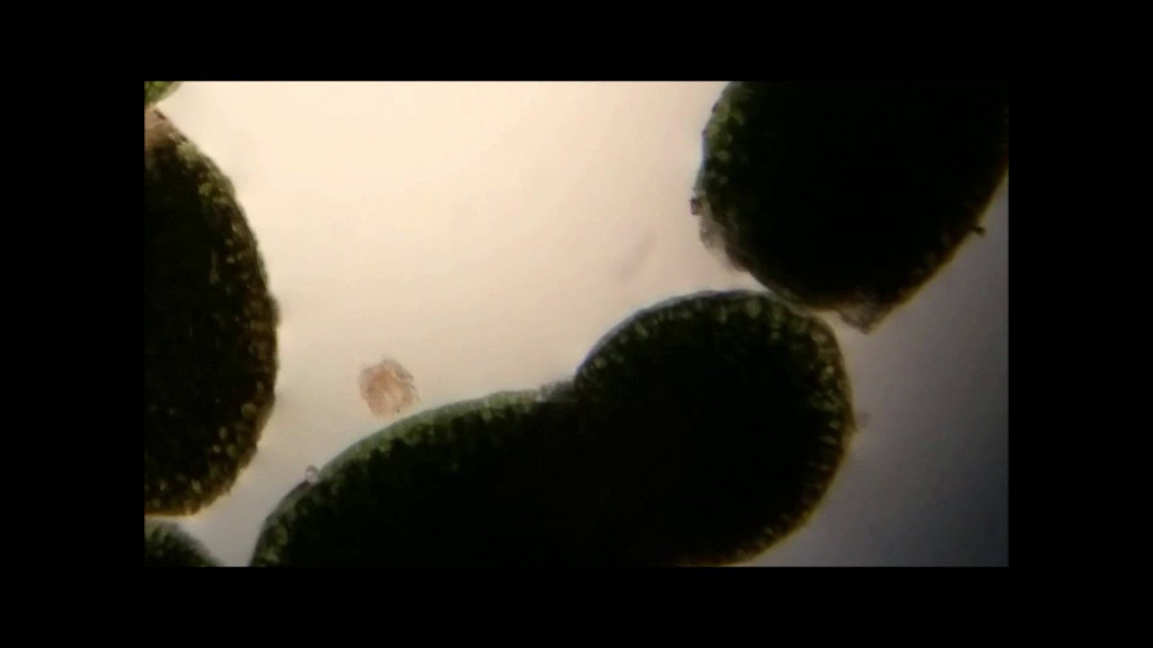 polyarthra rotifer - YouTube