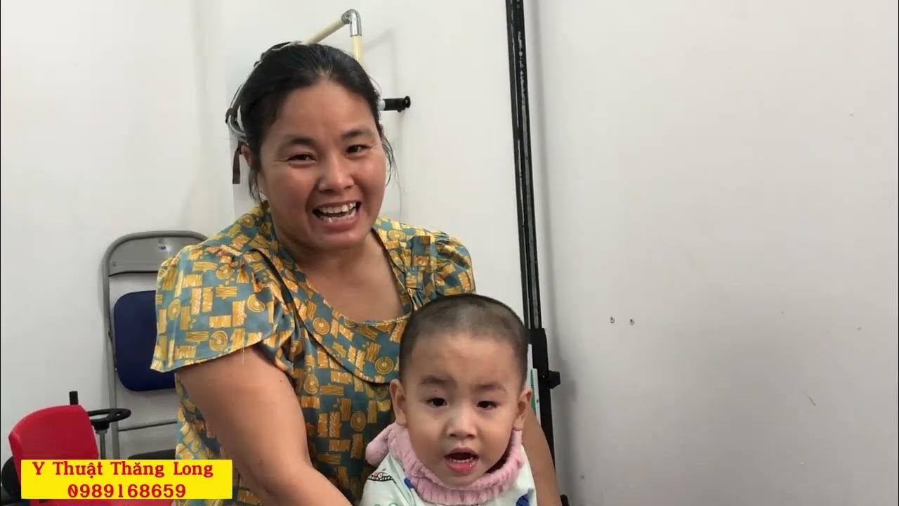 Bấm Huyệt Bại Não Thể Co Cứng Cải Thiện Cả Vận động Và Ngôn Ngữ Youtube