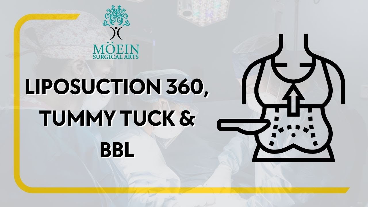 Liposuction 360, Tummy Tuck & BBL Transformation | Dr. Babak Moein’s ...
