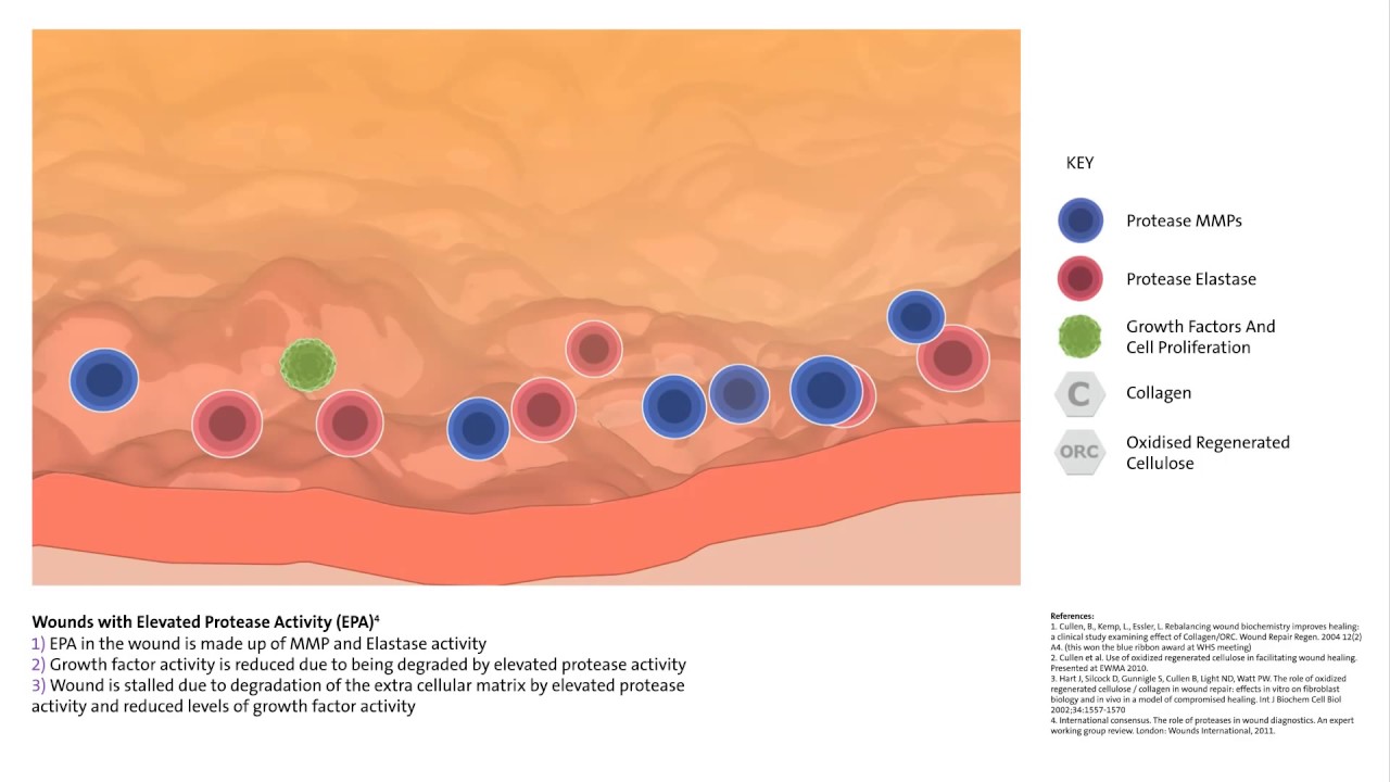 Systagenix Promogran Matrix Wound Dressing - YouTube