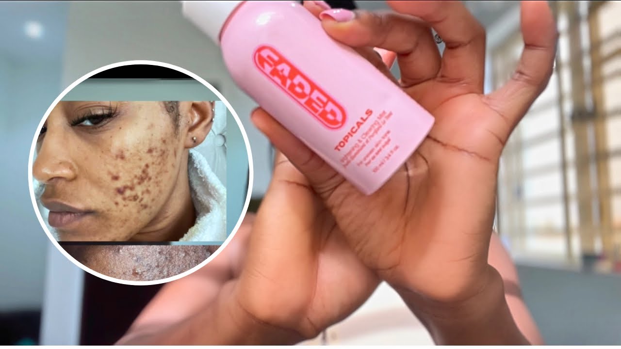Faded mist review|| How to use Faded mist by Topicals to get rid of Hyperpigmentation - YouTube