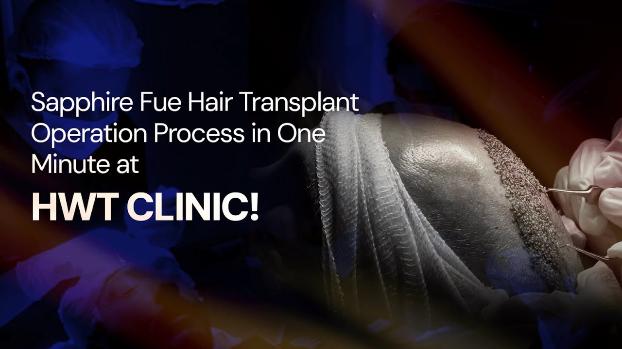 Sapphire Fue Hair Transplant Operation Process in One Minute at HWT ...