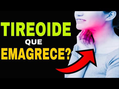 Tireoide Emagrece? Se sim, esse emagrecimento é bom ou ruim? (Hipertireoidismo)