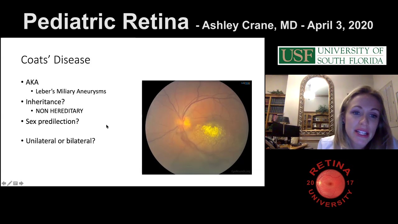 Pediatric Retina Review - April 4, 2020 - Ashley M. Crane, MD - YouTube