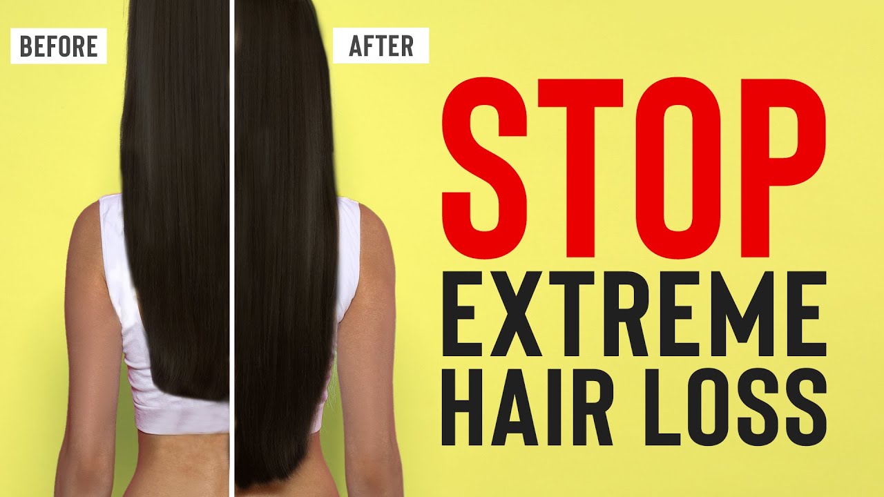 REGROW lost hair and stop EXTREME HAIR LOSS with these haircare tips ...
