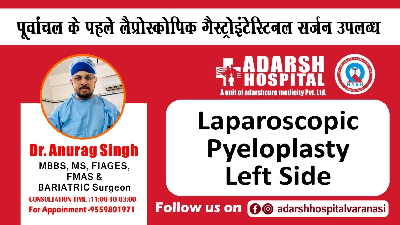 🔴 Laparoscopic Pyeloplasty Left Side done by Dr. Anurag Singh - YouTube