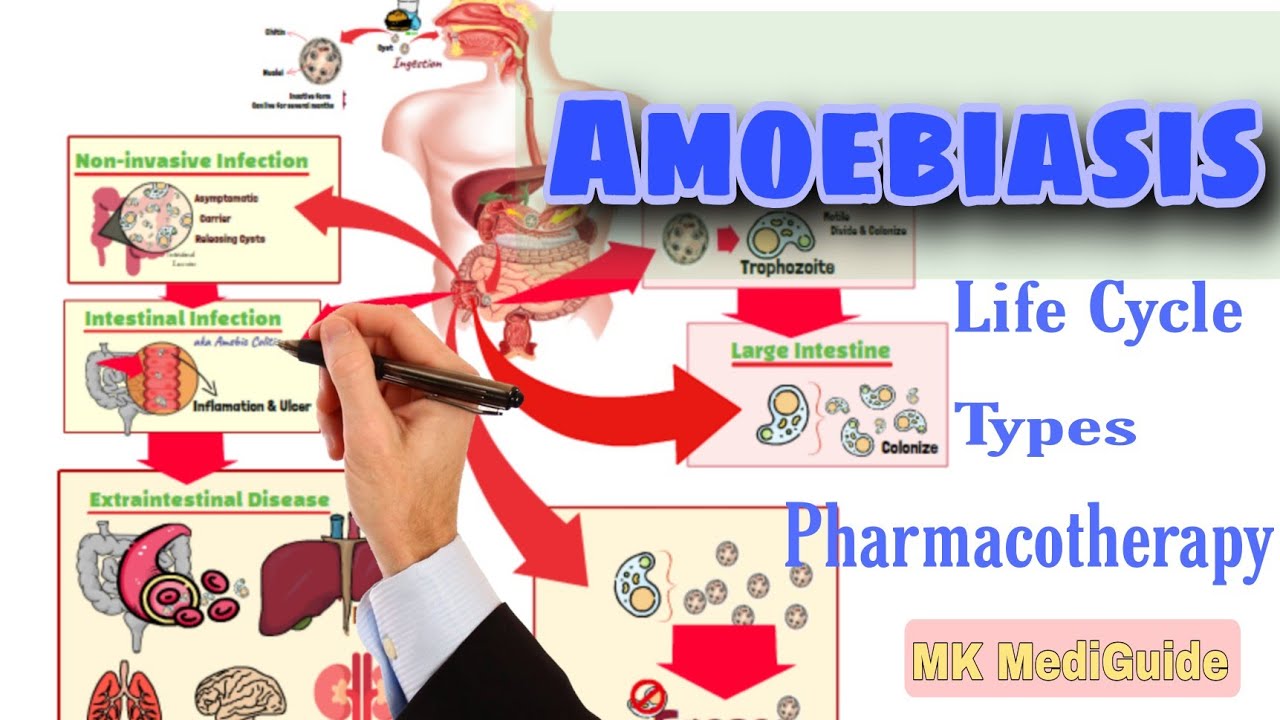 Intestinal Amoebiasis