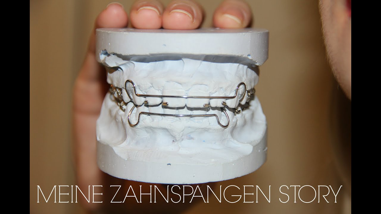 MEINE ZAHNSPANGE - YouTube