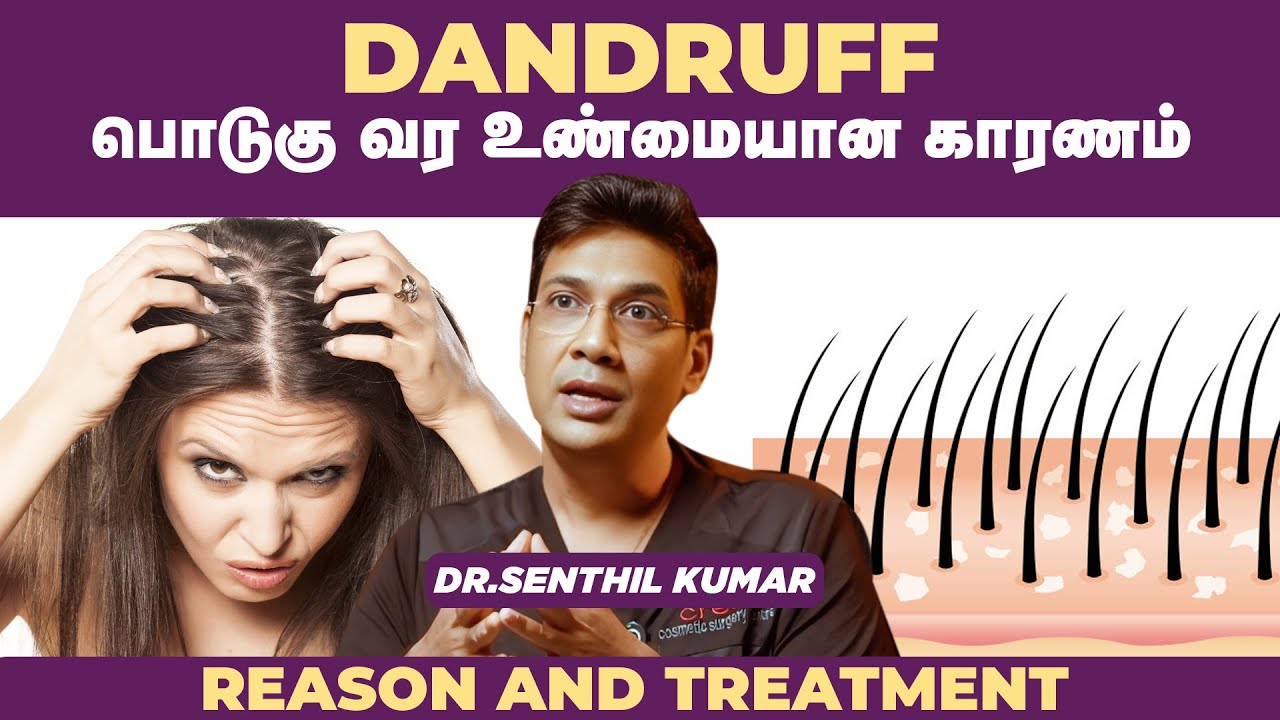 What is Real Causes for Dandruff? தலையில் பொடுகு வர உண்மையான காரணம் ...