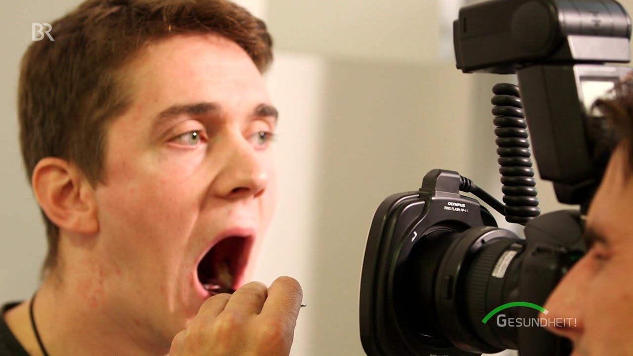 Mandeln Wann sollte operiert werden - YouTube