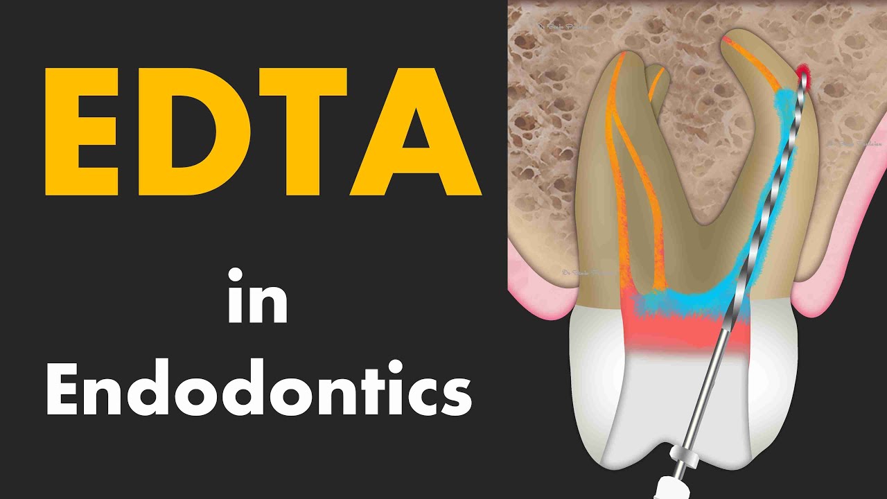 EDTA in Root Canal Treatment - YouTube