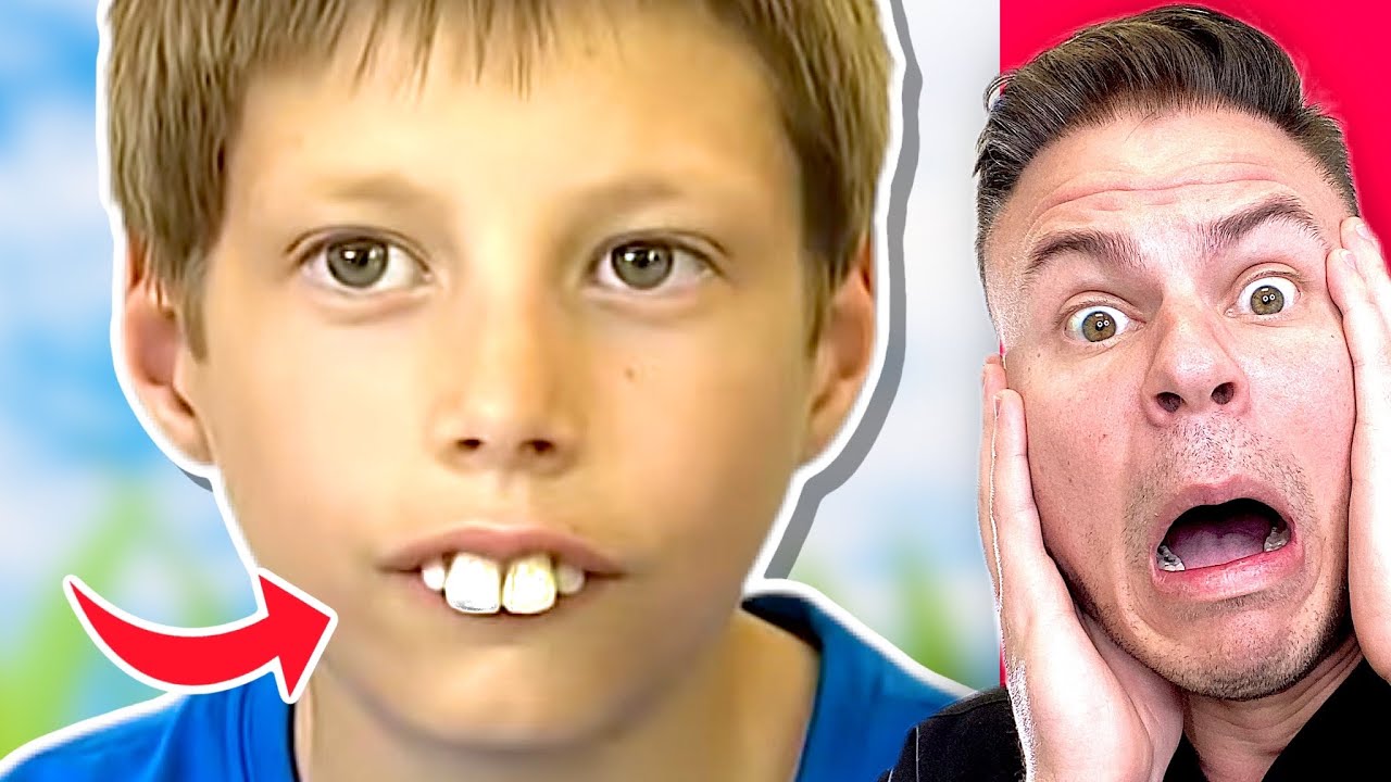 Orthodontist Reacts! Biggest Front Teeth EVER! - YouTube