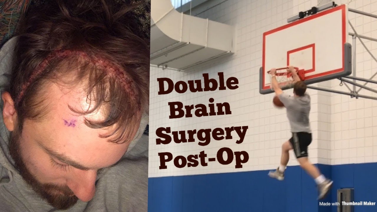 Post-Op Double Brain Surgery Comeback - YouTube