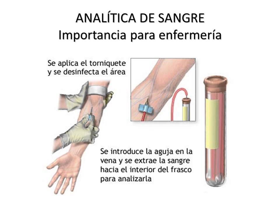 Practica simulada de venopunción - YouTube