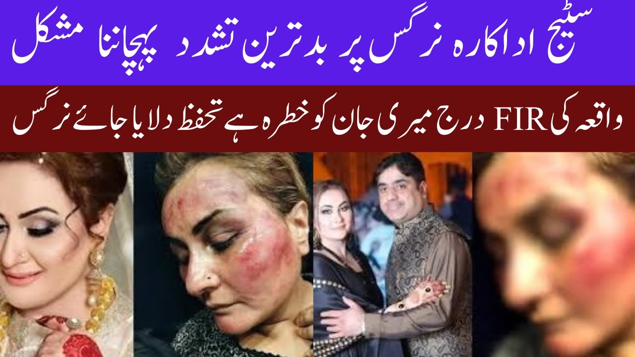 Stage Actress Nargis Allegedly Tortured By Inspector Police Majid ...
