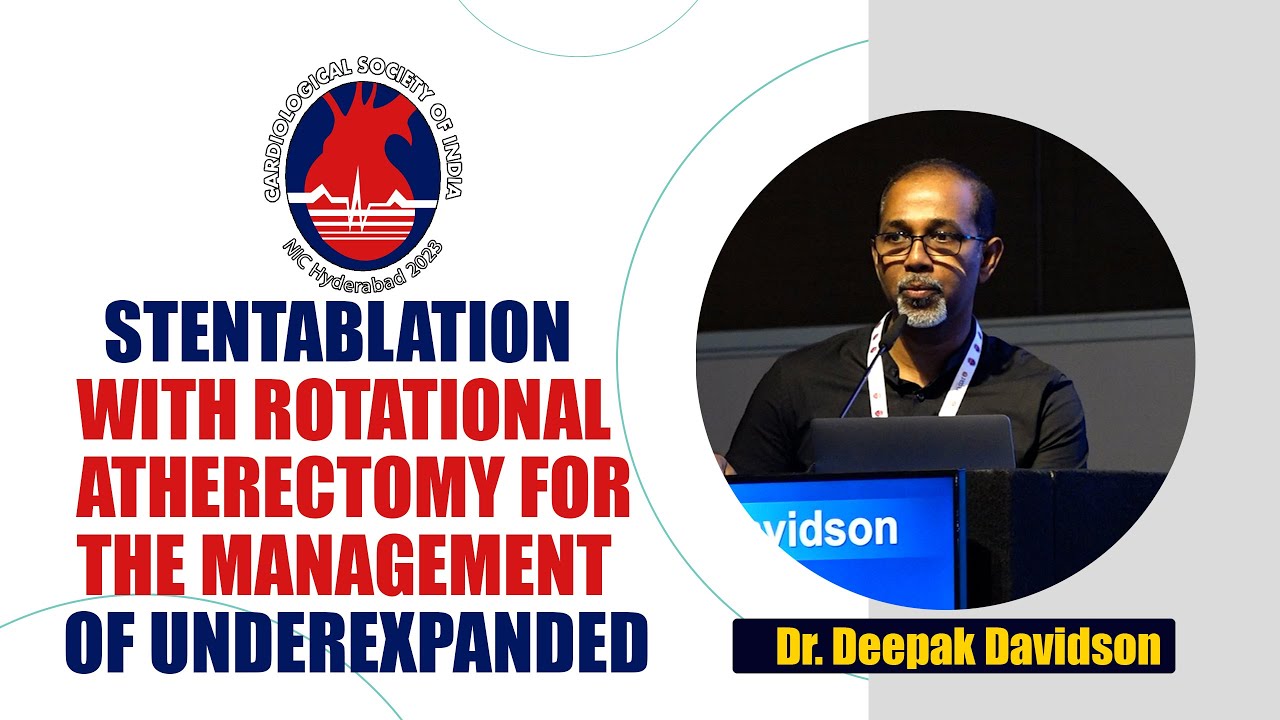 Stent Ablation with Rotational Atherectomy By Dr. Deepak Davidson | CSI ...