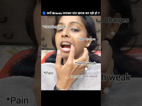 🥹❤️‍🩹Khud ke liye jio || Braces Transformation With Self satisfaction #ytshorts #shorts