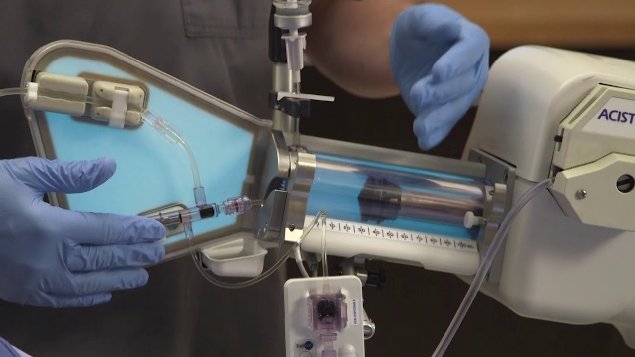 ACIST U - CVi™ Manifold Valve Open - YouTube