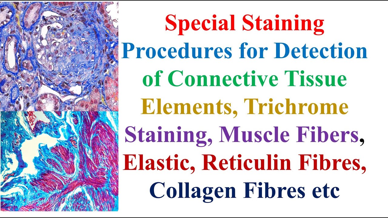 #Special Staining Procedures for Detection of #Connective #Tissue # ...