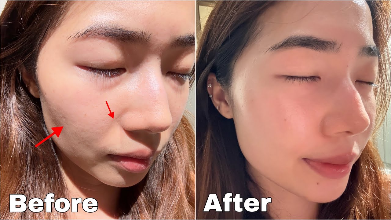 NEW CURRENTBODY LED MASK SERIES 2 REVIEW AFTER 1 MONTH! Red Light ...