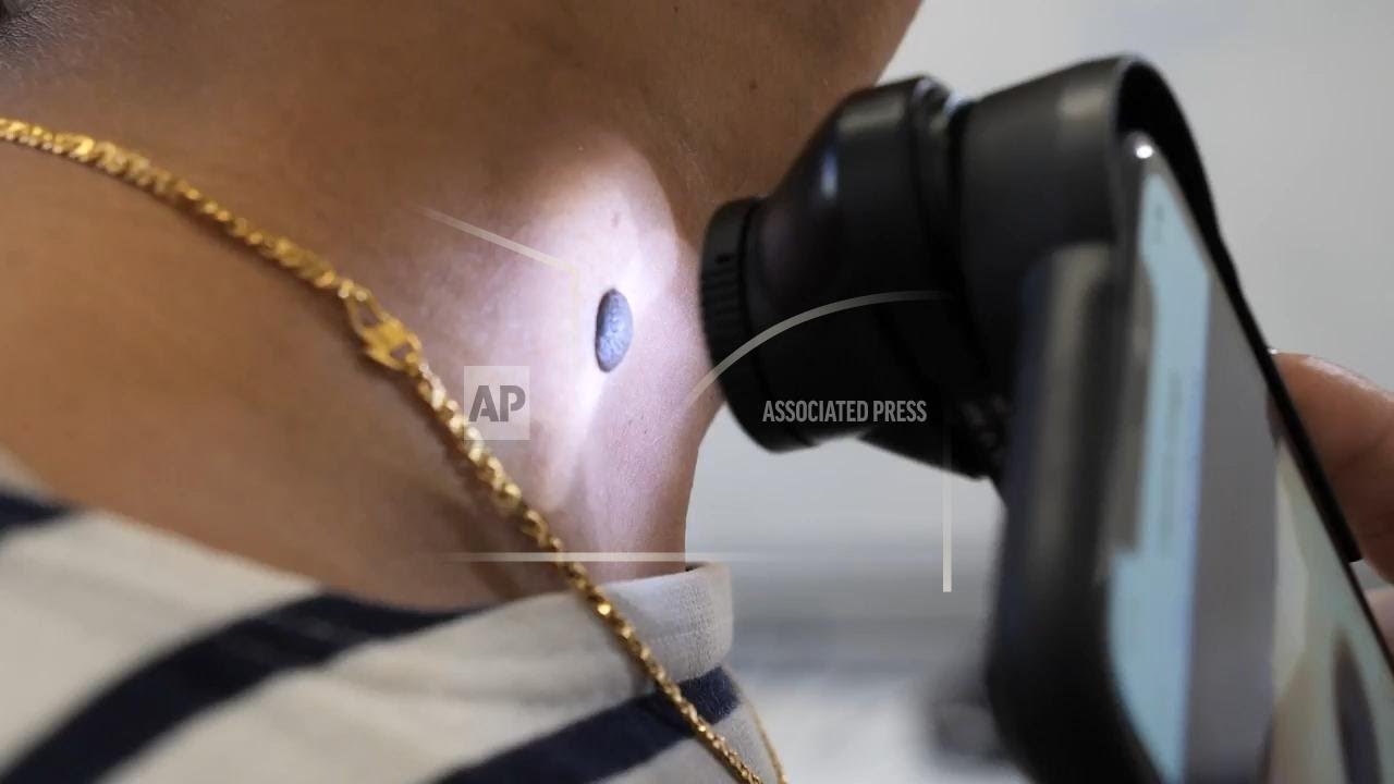 AI skin cancer detection app claims 99.8 per cent accuracy rate in ...