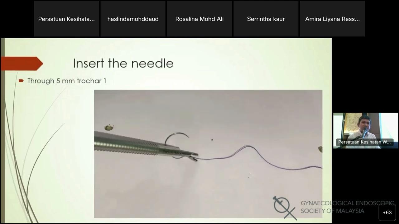 ENDOSCOPIC SUTURING TIPS AND TRICKS - YouTube