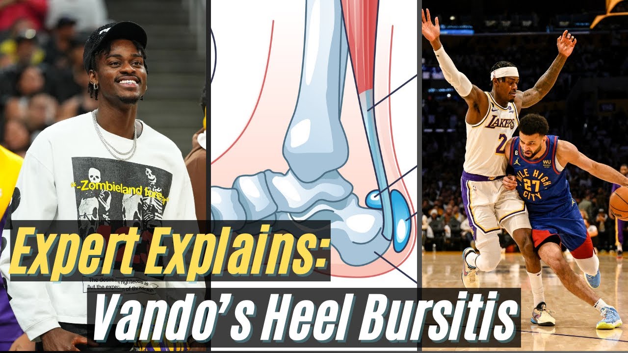 Expert Explains Lakers Jarred Vanderbilt’s heel bursitis & timeline ...