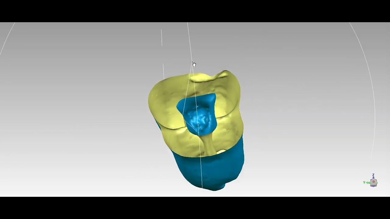 Atlas anatomía dental 3D. Anatomía del sistema de conductos diente 4.8 ...