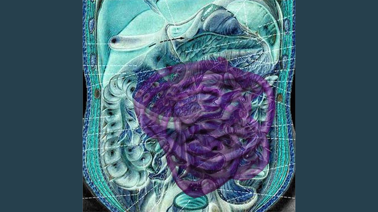 Surgical Removal of Worms - YouTube