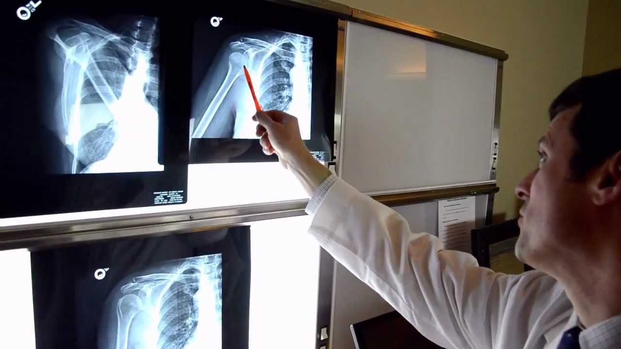 Information Video - Advanced Bone & Joint - YouTube