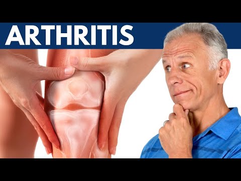 What I Wish Everyone Would Know About Arthritis!