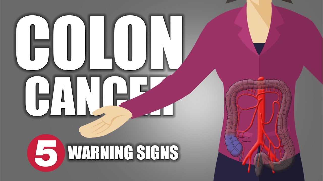 5 warning signs of colon cancer you should not ignore #cancer #warning ...