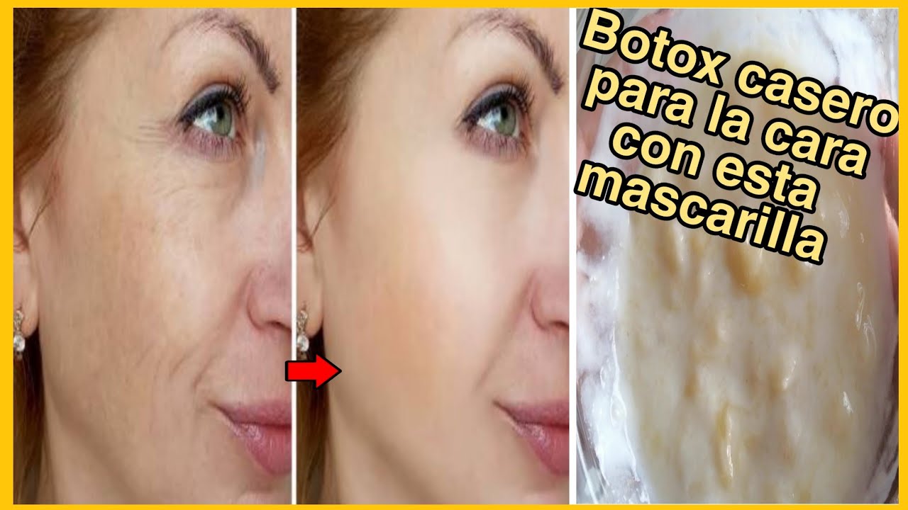 botox casero para la cara con esta mascarilla para eliminar arrugas ...