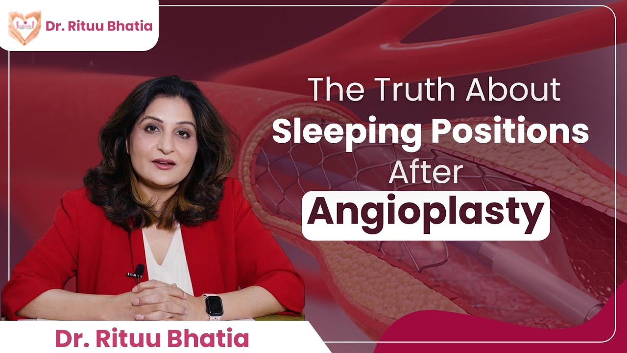 Balloon Angioplasty & Stents: Recovery Tips & Safe Sleep Positions ...