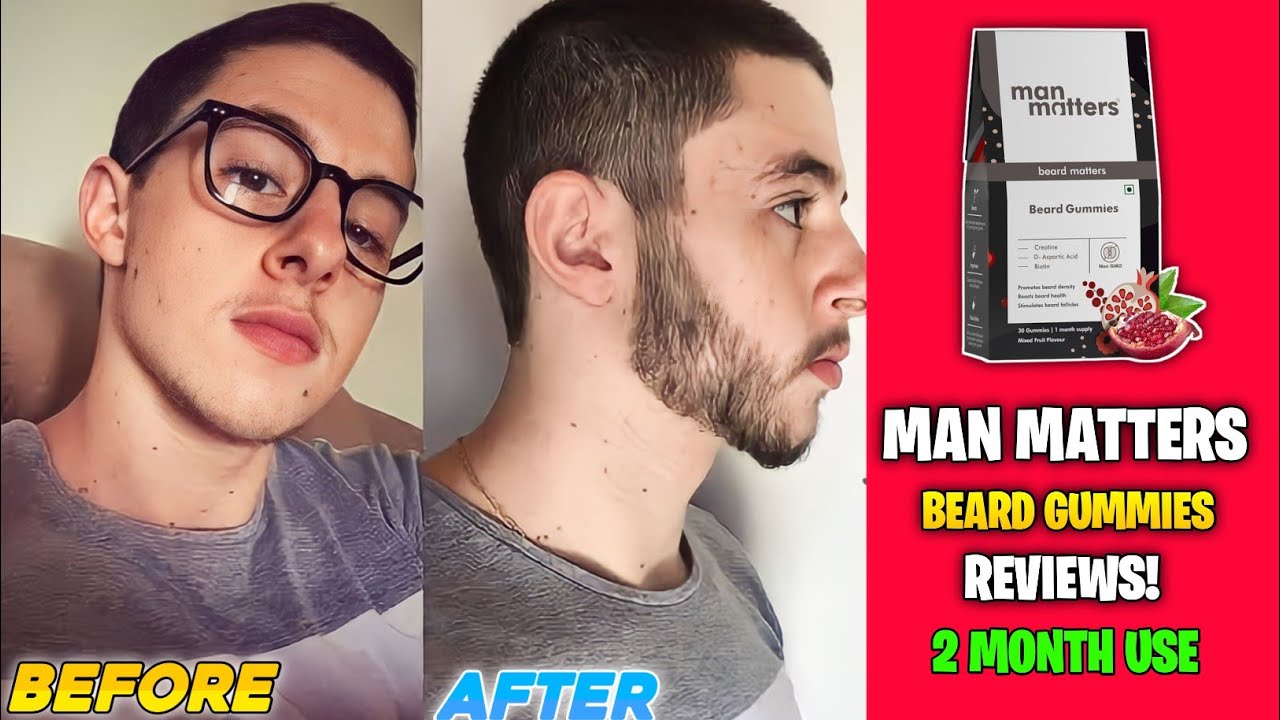 सिर्फ 2 महीने में दाढ़ी उगाए | man matters beard gummies review | how ...