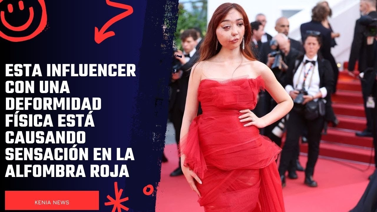 Nikki Lilly Esta influencer con una deformidad física está causando ...