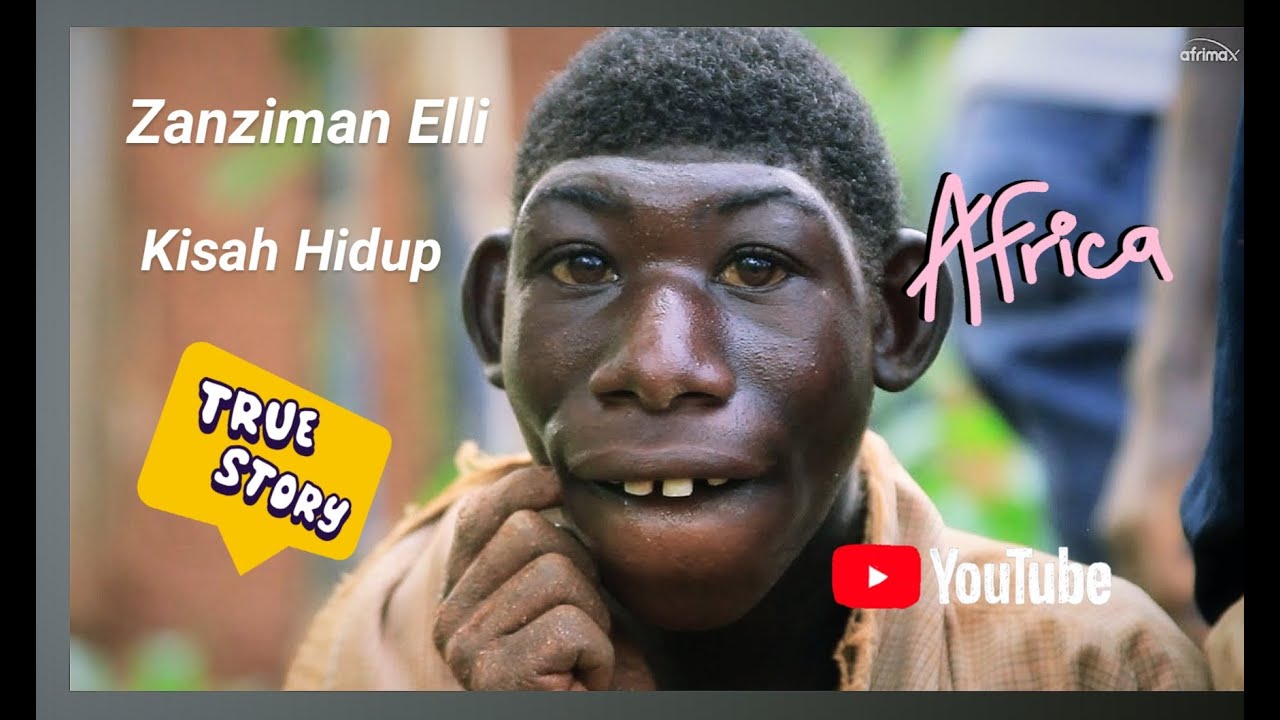 kisah Hidup Zanziman Elli ( They Call Him Monkey) - YouTube