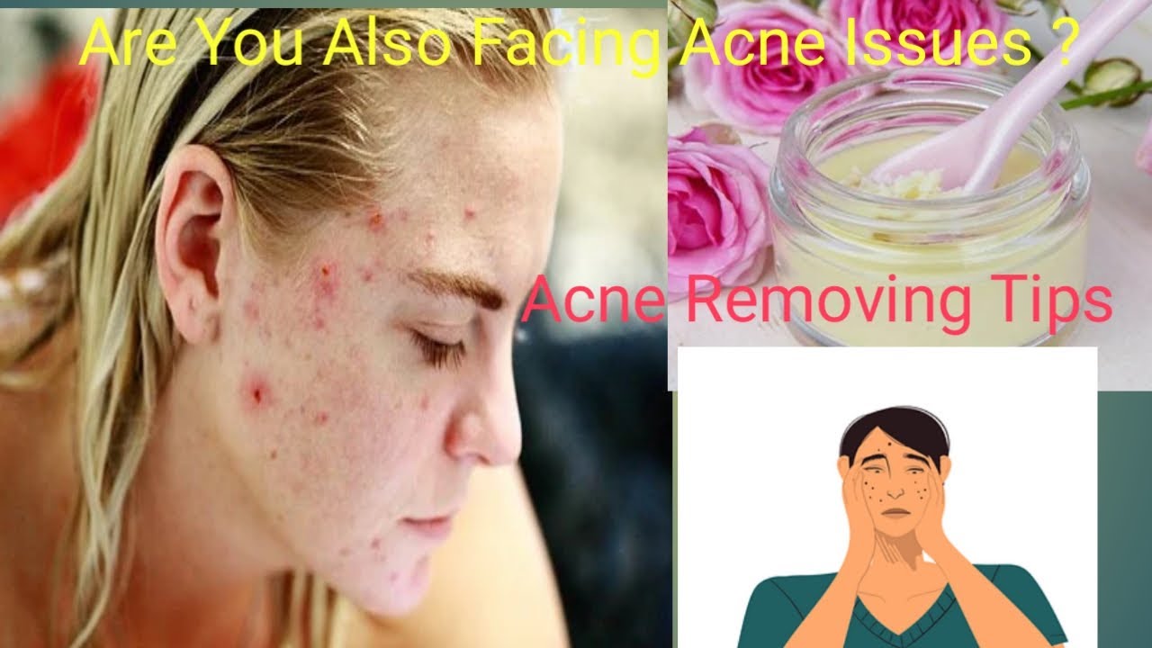 Foods that help to remove acne || Acne problem solution by organic ...