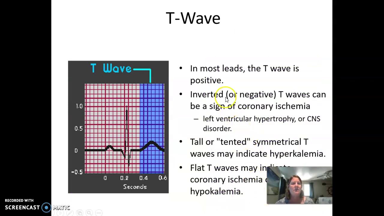 Telemetry Monitoring and wave forms - YouTube
