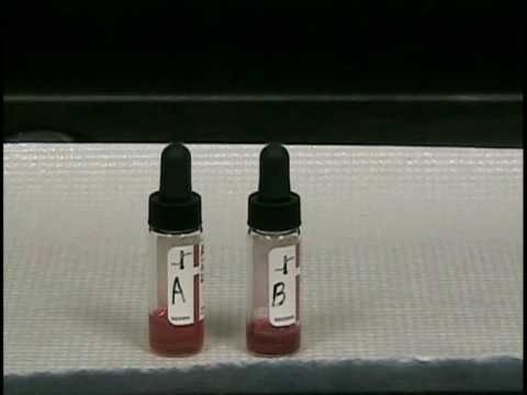 ABO Rh Group Typing Tube Method.wmv - YouTube