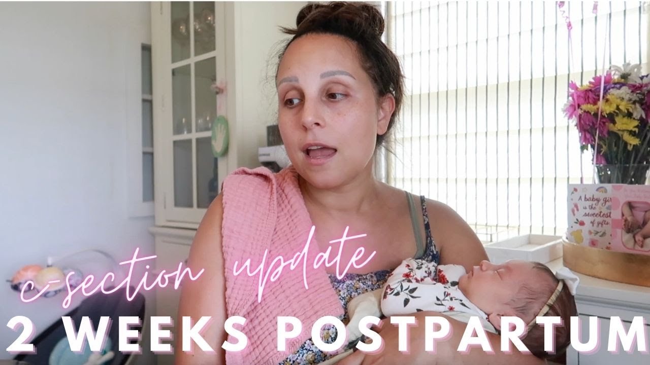2 WEEK POSTPARTUM UPDATE | healing from a repeat c-section 👎🏻 - YouTube